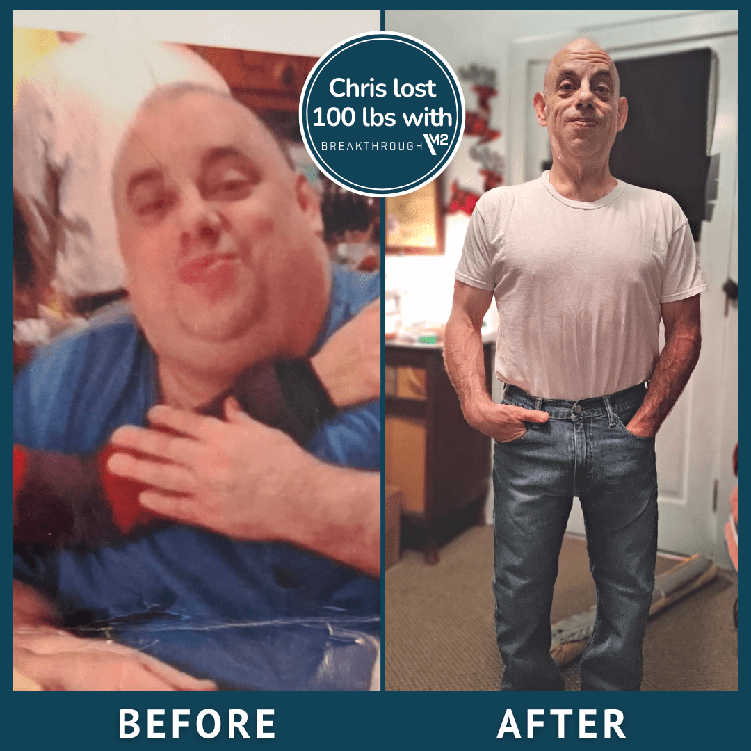 From 410 Pounds to a New Life with Breakthrough M2